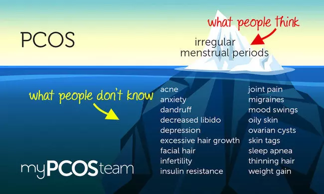 PCOS: What People Don't Know (Infographic) | myPCOSteam
