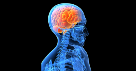 Tonic-Clonic Seizures Explained | MyEpilepsyTeam