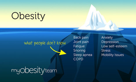 Obesity and Fatigue | MyObesityTeam