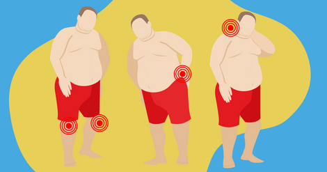 Obesity and Fatigue: Causes and 4 Tips for Energy | MyObesityTeam
