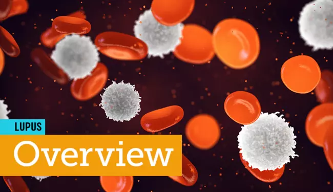 Lupus – An Overview | MyLupusTeam