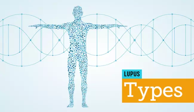 Types of Lupus | MyLupusTeam