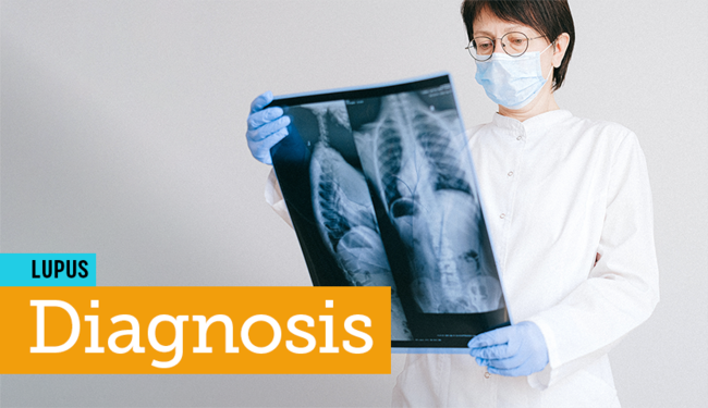 Your Guide to Lupus: Symptoms, Treatments, and More | MyLupusTeam