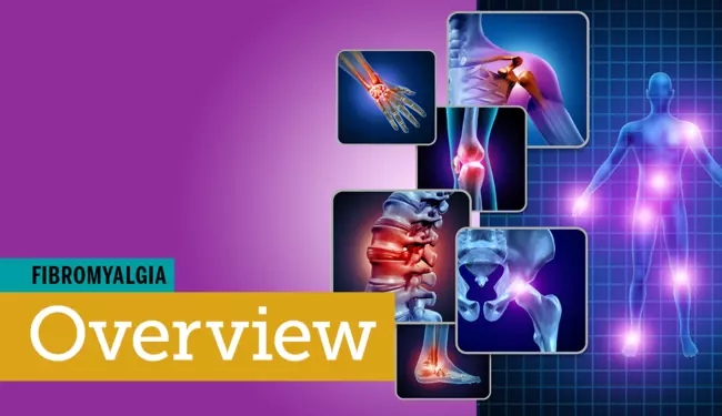 Fibromyalgia – An Overview | MyFibroTeam