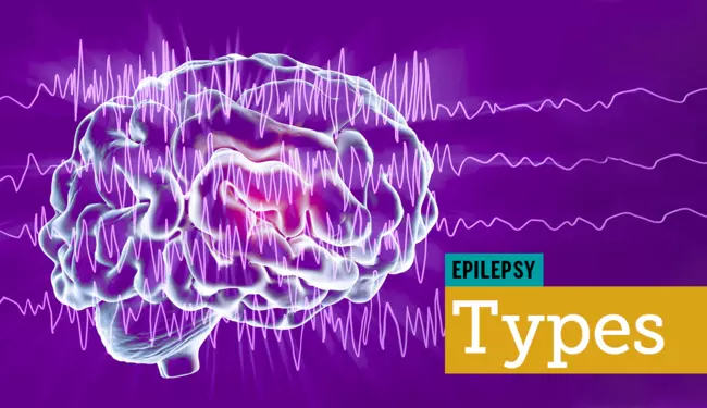 Types of Epilepsy | MyEpilepsyTeam