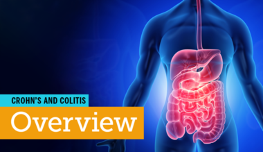 Your Guide to Crohn's and Colitis: Symptoms, Treatments, and More ...