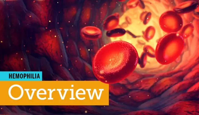 Hemophilia – An Overview | MyHemophiliaTeam