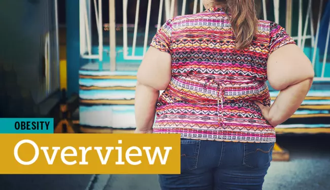 Obesity - An Overview | MyObesityTeam