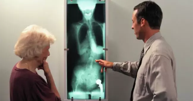 More Doubt Cast on Surgery for Spinal Compression Fractures | MyOsteoTeam