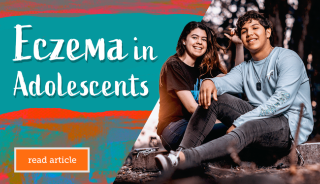 Living with Eczema | MyEczemaTeam