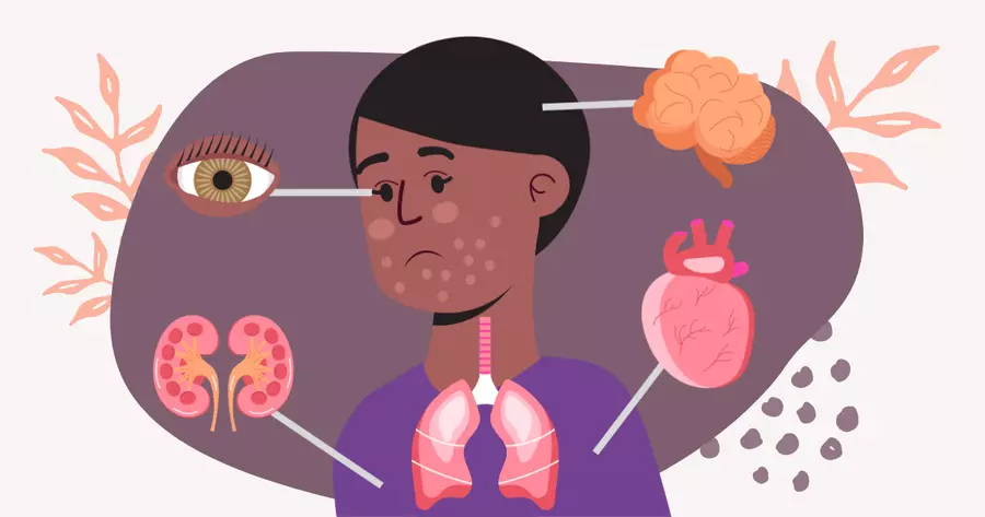 tuberous sclerosis complex 2