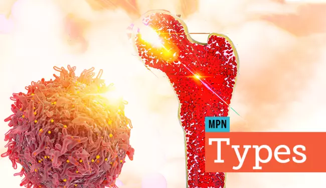 Types of Myeloproliferative Neoplasms (MPNs) | myMPNteam