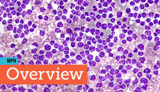 Your Guide to MPN: Symptoms, Treatments, and More | myMPNteam