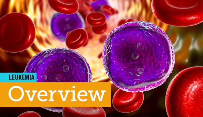 Leukemia — An Overview | MyLeukemiaTeam