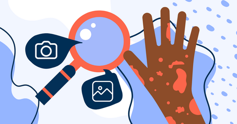 Ulcerative Colitis and Rheumatoid Arthritis: Understanding the ...