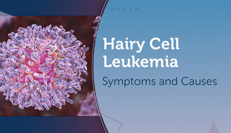 T-Cell Prolymphocytic Leukemia (T-PLL) — An Overview | MyLeukemiaTeam
