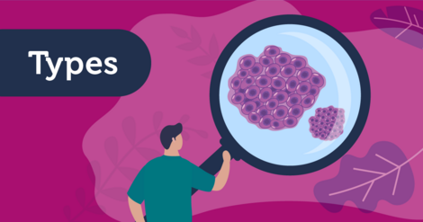 Benign Lymphoma: Your Guide | MyLymphomaTeam