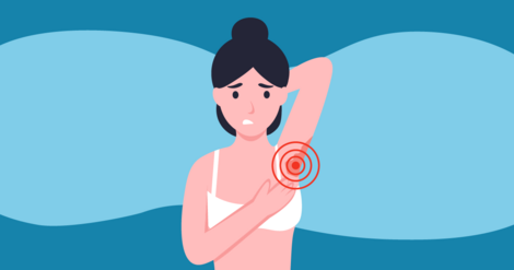 Visual Guide to Hidradenitis Suppurativa (HS): Photos of Symptoms ...