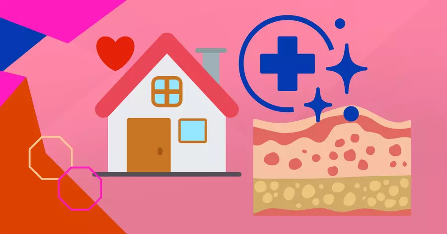 HS Boils and Lumps: How To Manage at Home (VIDEO) | myHSteam
