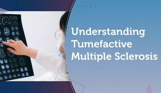 Understanding Tumefactive Multiple Sclerosis | MyMSTeam