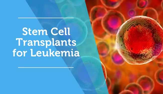 Stem Cell Transplants for Leukemia | MyLeukemiaTeam