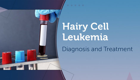 T-Cell Prolymphocytic Leukemia (T-PLL) — An Overview | MyLeukemiaTeam