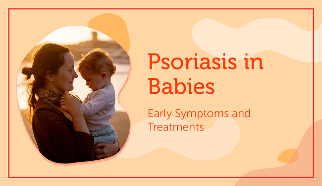 Psoriasis General Information | MyPsoriasisTeam