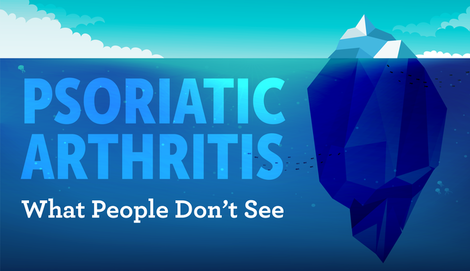 Can Psoriasis Cause Swollen Lymph Nodes? | MyPsoriasisTeam