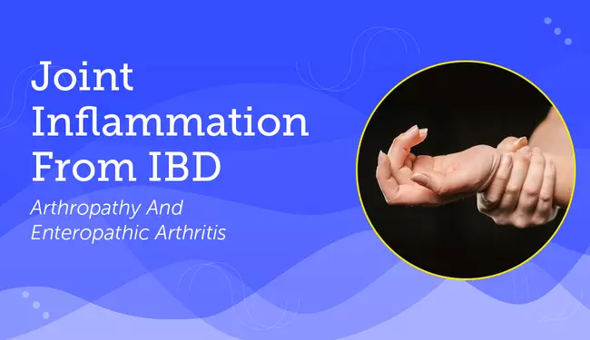 Joint Inflammation From IBD: Arthropathy And Enteropathic Arthritis ...