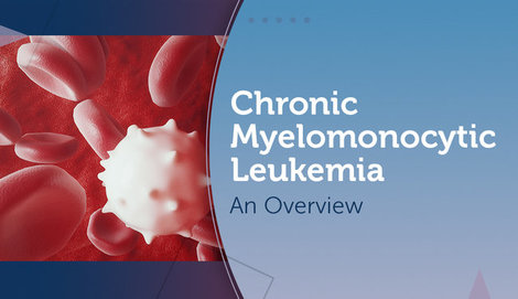 Chronic vs. Acute Leukemia: Understanding the Difference | MyLeukemiaTeam