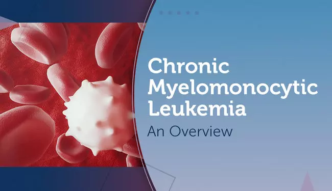 Chronic Myelomonocytic Leukemia: An Overview | MyLeukemiaTeam
