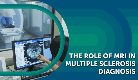 Diagnosing MS: How Doctors Test for MS | MyMSTeam
