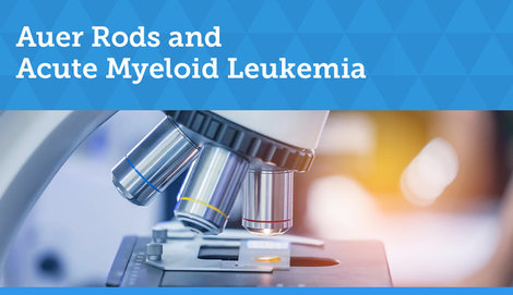 Blood Tests for Leukemia: What To Expect | MyLeukemiaTeam
