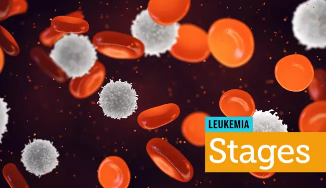 Stages of Leukemia: Your Guide | MyLeukemiaTeam
