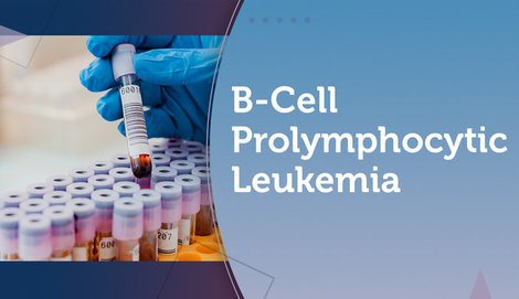 Acute Lymphoblastic Leukemia (ALL) vs. Acute Myeloid Leukemia (AML ...