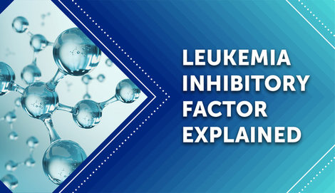 What Causes Leukemia? | MyLeukemiaTeam
