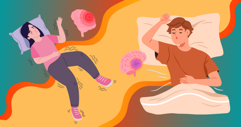 Sleep Cycles and REM Sleep in Narcolepsy | MyNarcolepsyTeam