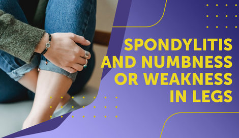 Imaging in Ankylosing Spondylitis | MySpondylitisTeam