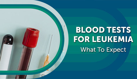 Imaging Tests for Leukemia: What To Know | MyLeukemiaTeam
