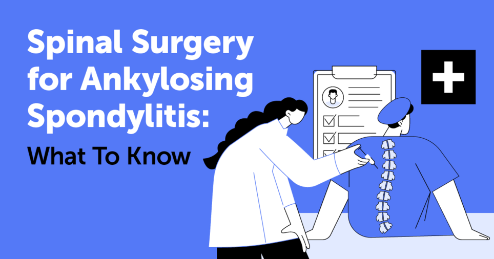 Treating Spondylitis | MySpondylitisTeam