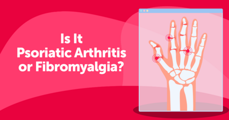 Types of Blood Tests for Psoriatic Arthritis | MyPsoriasisTeam