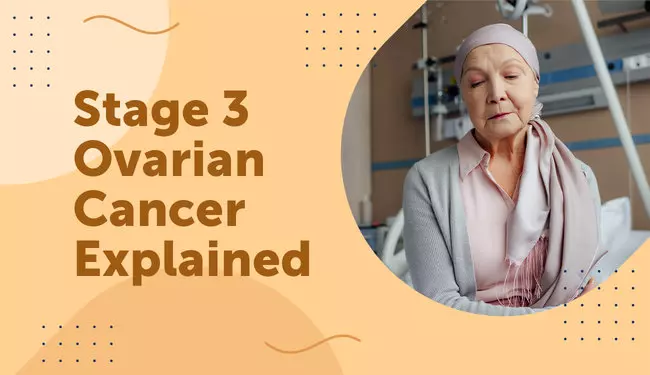 Stage 3 Ovarian Cancer Explained | MyOvarianCancerTeam
