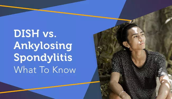 DISH vs. Ankylosing Spondylitis: What To Know | MySpondylitisTeam