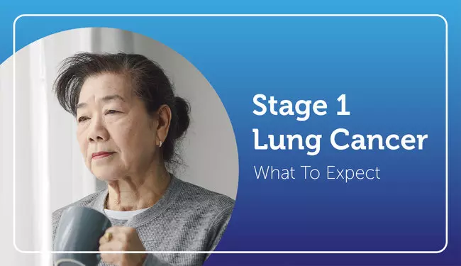 Stage 1 Of Lung Cancer