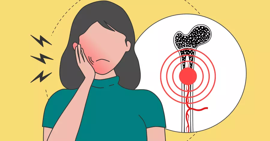 does multiple myeloma affect teeth