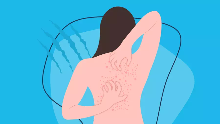 Itchy Skin and Multiple Myeloma: How Does Blood Cancer Cause Itching ...