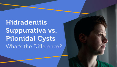 Hidradenitis Suppurativa or Acne Blackheads: What’s the Difference ...