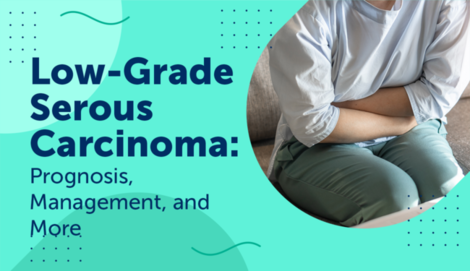 High-Grade Serous Carcinoma: Prognosis, Management, and More ...