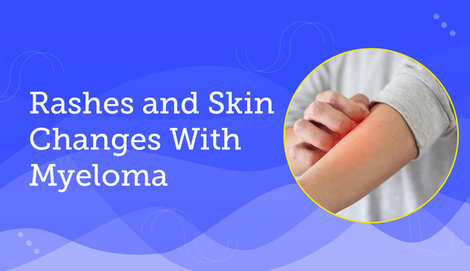 Itchy Skin and Multiple Myeloma | MyMyelomaTeam