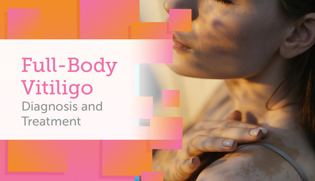 The social network for those living with vitiligo. | MyVitiligoTeam